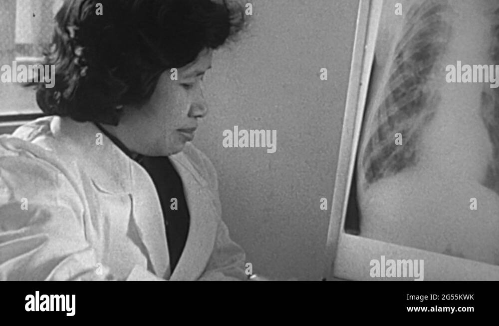 1950s Tuberculosis Clinic TB China Doctor Patient X-Ray Vintage Old ...