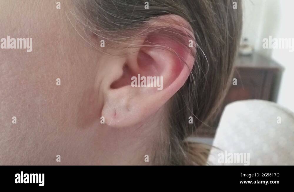 Sound block ears Stock Videos & Footage - HD and 4K Video Clips - Alamy