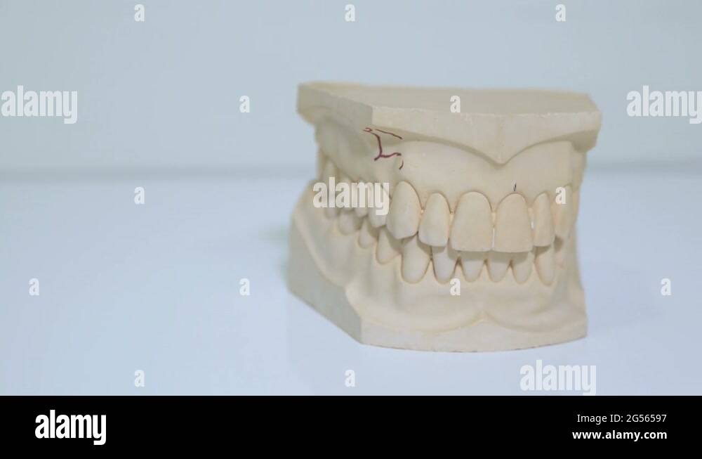 Dental mould Stock Videos & Footage - HD and 4K Video Clips - Alamy