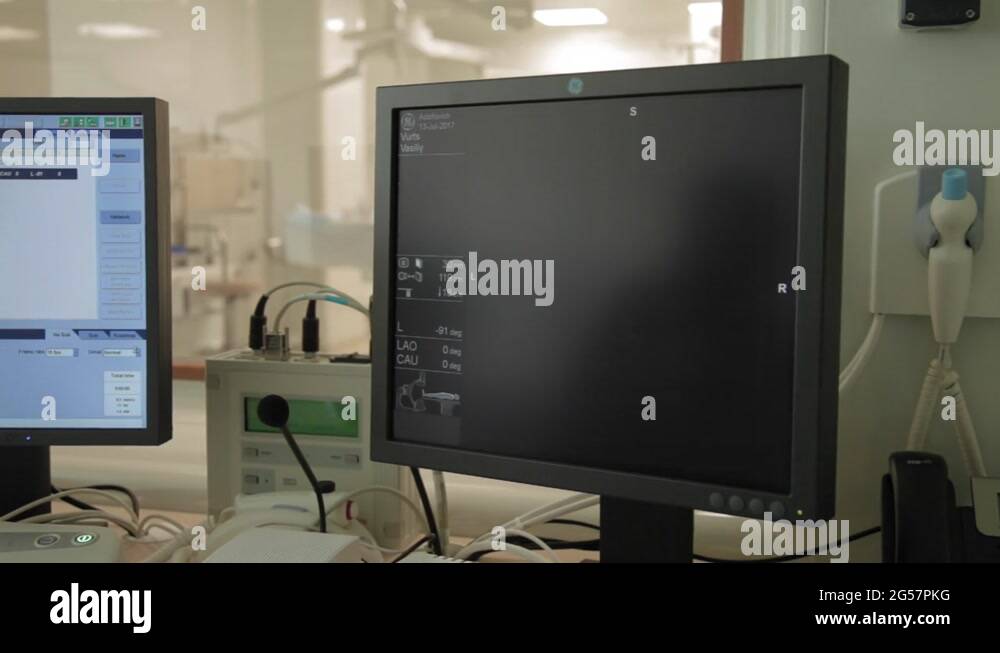 screen with manipulations at angiographic operation room Stock Video ...
