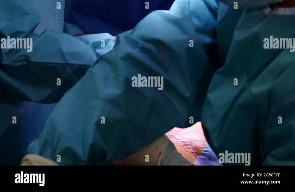 Rib cage open Stock Videos & Footage - HD and 4K Video Clips - Alamy