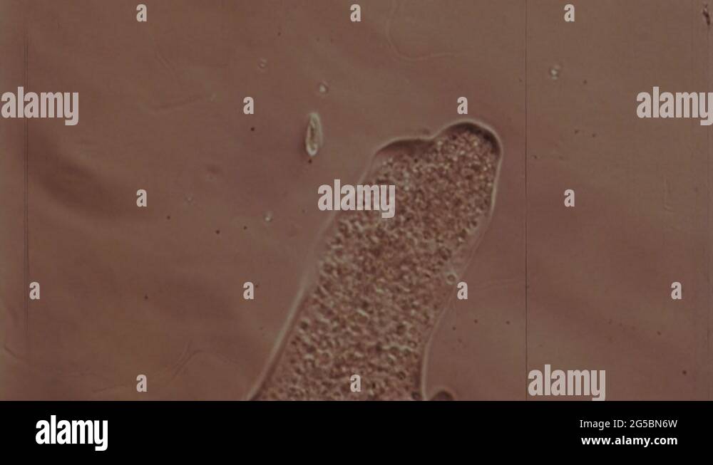 Amoeba Microscopic Microscope Cell Microorganism Biology Vintage 16mm ...