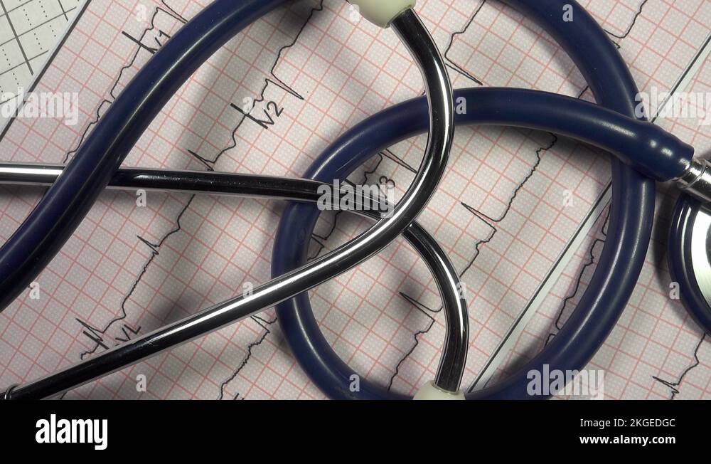 Ecg graph heart Stock Videos & Footage - HD and 4K Video Clips - Alamy