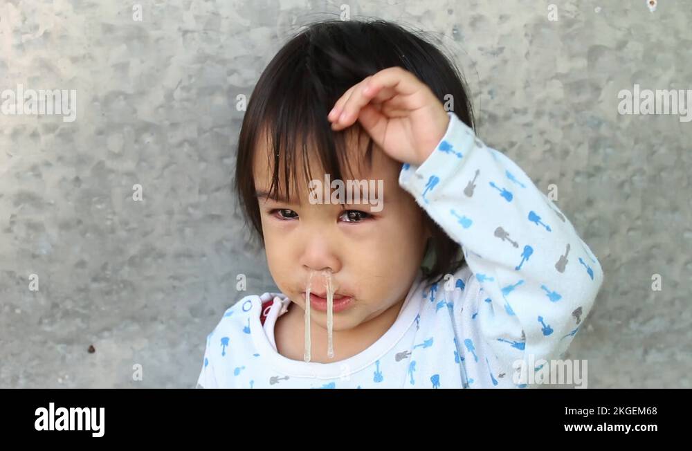 Mucus flowing from nose Stock Videos & Footage - HD and 4K Video Clips ...