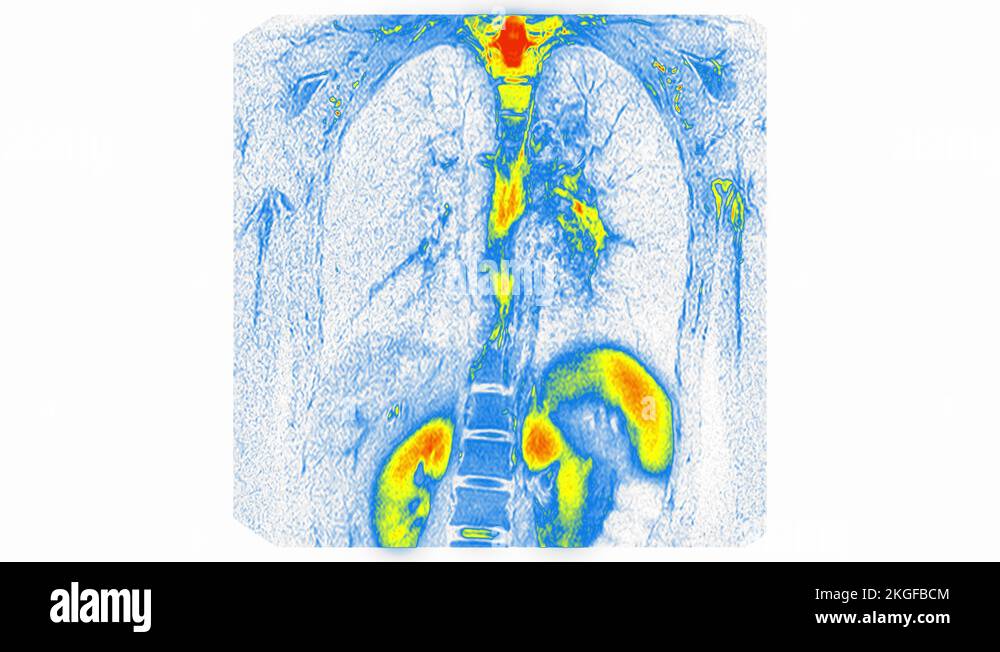 Computed Medical Tomography MRI Upscaled Scan of Healthy Young Female ...