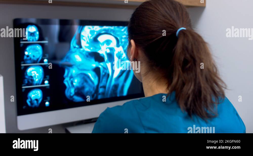 Professional female doctor neurologist working with brain MRI scans on ...