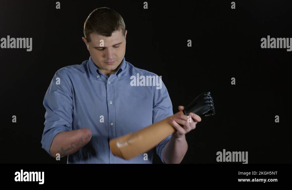 Amputee Man Fitting New Prosthetic Arm Stock Video Footage Alamy