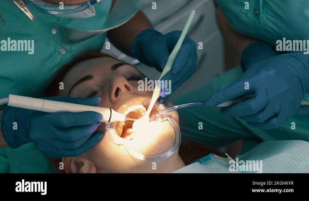 Ultrasonic cleaning of teeth. Removal of solid teeth Stock Video ...