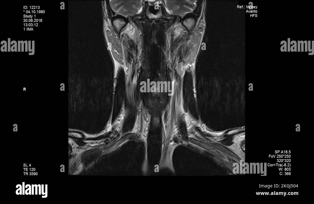Lumbar Spine Anatomy Stock Videos And Footage Hd And 4k Video Clips Alamy