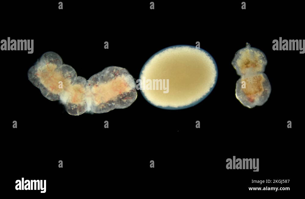 egg, embryo, cocoon of the worm Tubifex tubifex, under the microscope ...