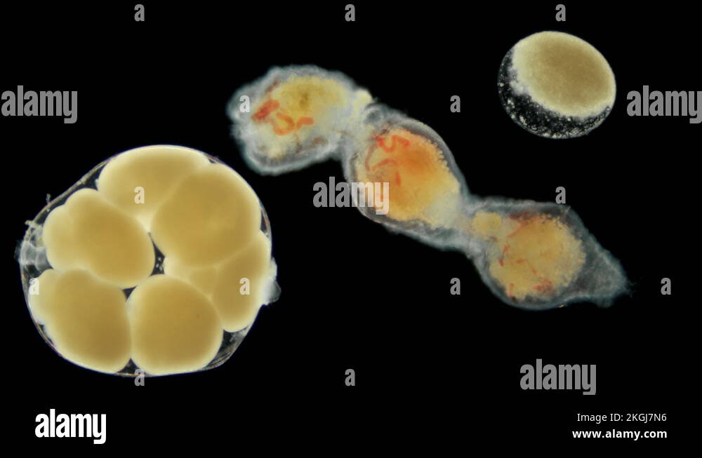 egg, embryo, cocoon of the worm Tubifex tubifex, under the microscope ...