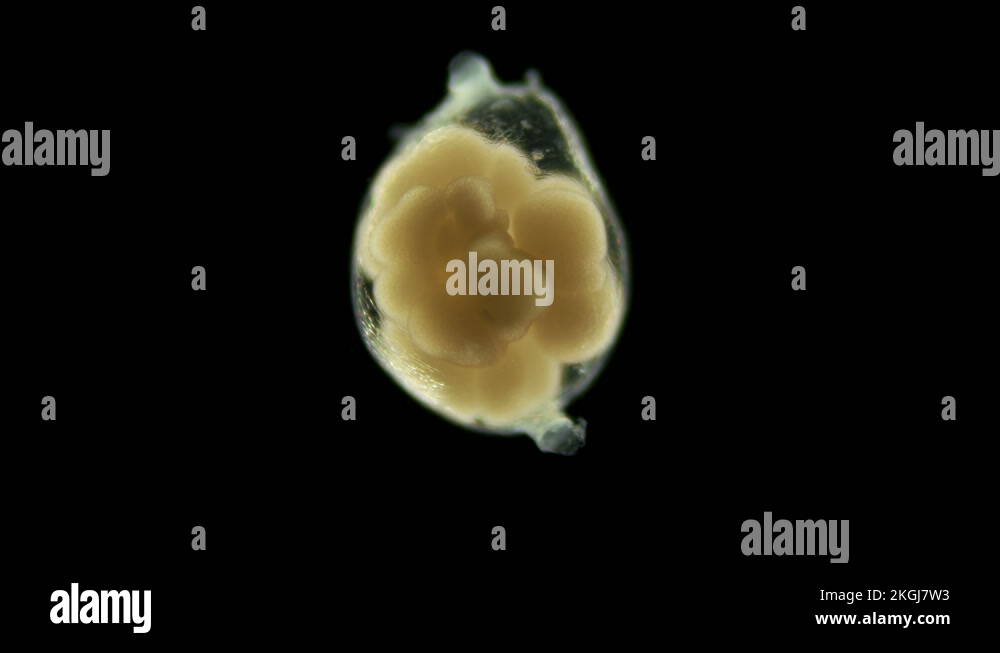 egg, embryo, cocoon of the worm Tubifex tubifex, under the microscope ...