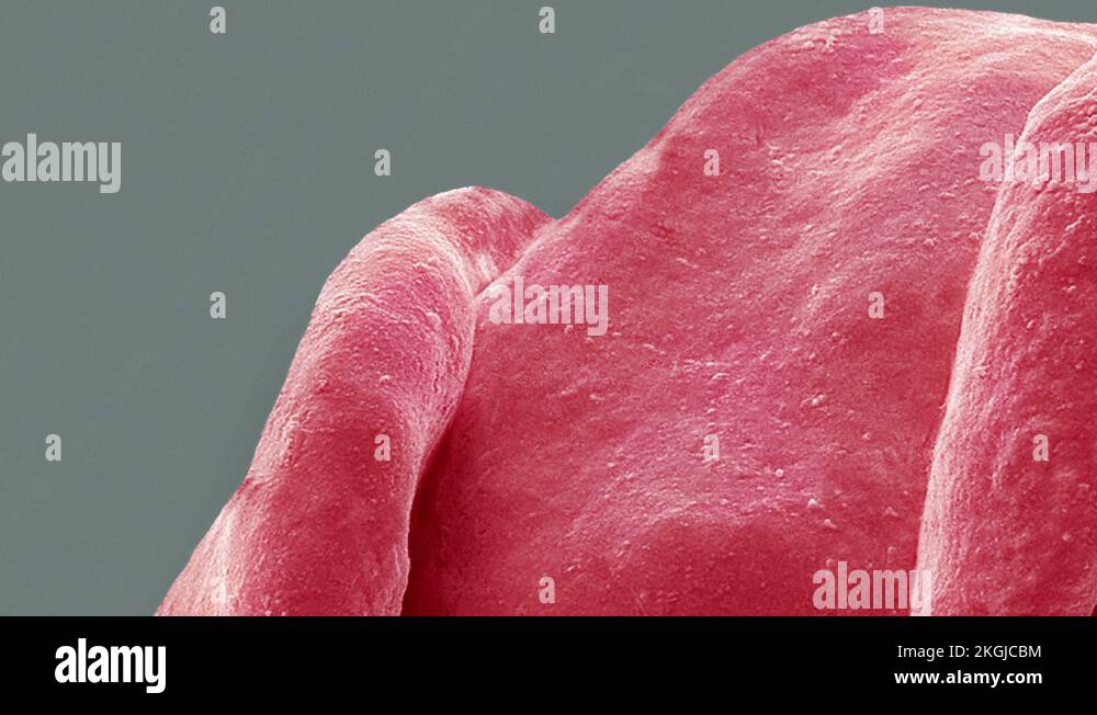 Electron micrograph red blood cells sem Stock Videos & Footage - HD and ...