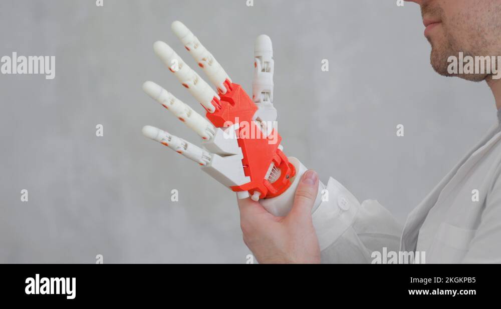 Doctor orthopedist conducts tests of robotic prosthetic hand trying to ...