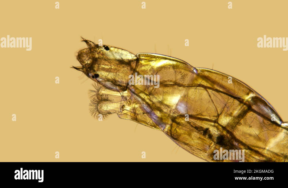 insect larva Chironomidae under the microscope Stock Video Footage - Alamy