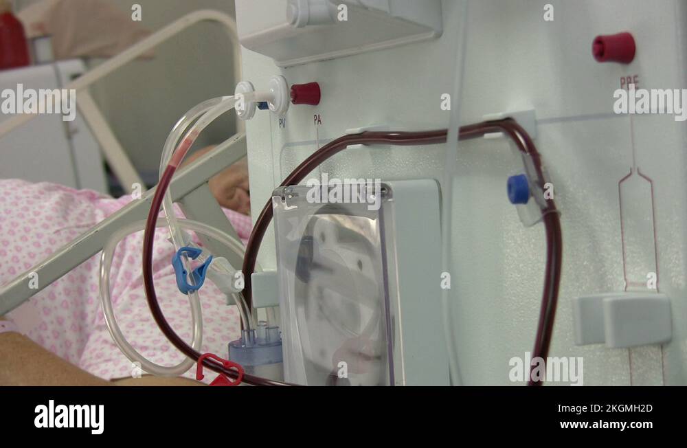 Hemodialysis Stock Videos & Footage - HD and 4K Video Clips - Alamy
