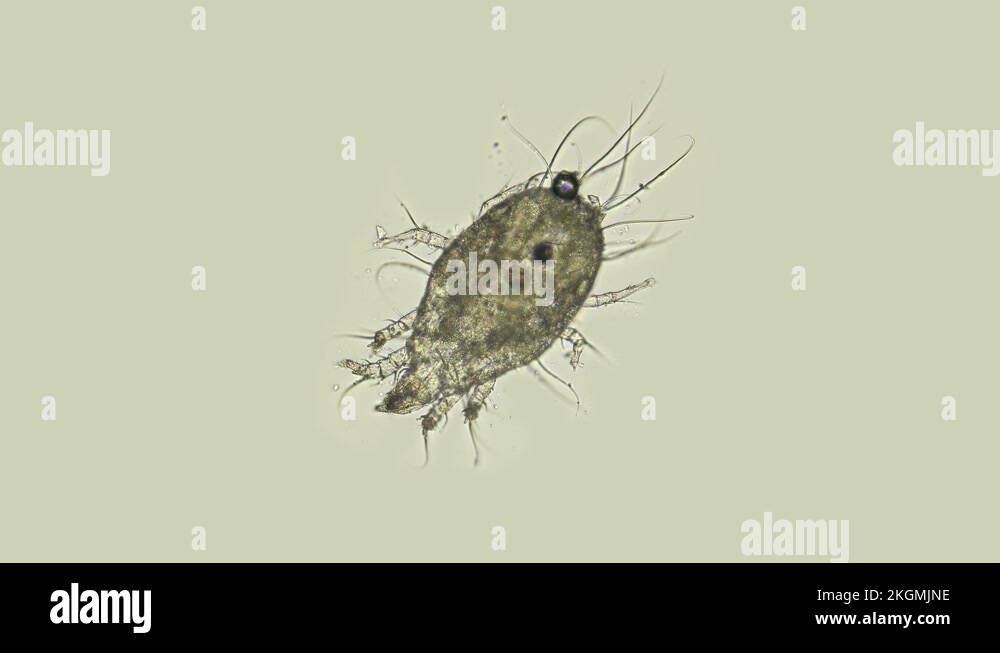 a granary or flour mite under a microscope Stock Video Footage - Alamy