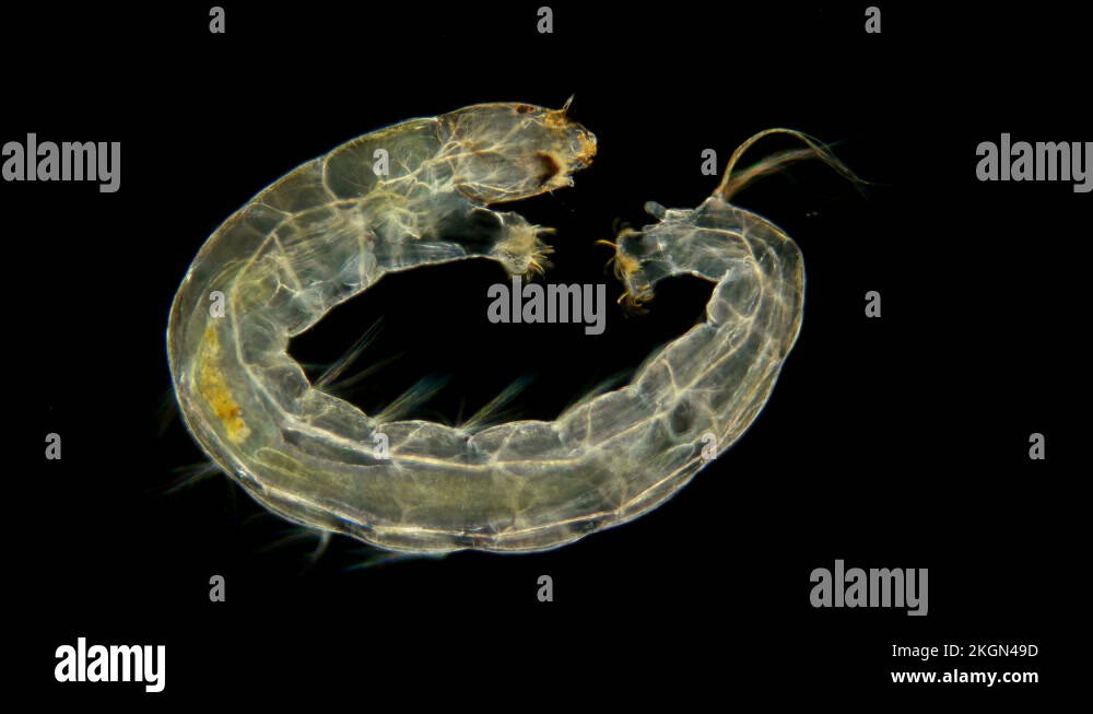 insect larva Chironomidae under the microscope Stock Video Footage - Alamy