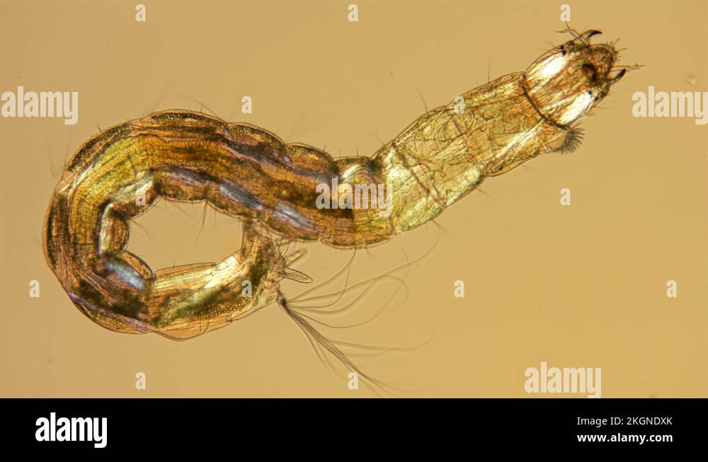 insect larva Chironomidae under the microscope Stock Video Footage - Alamy