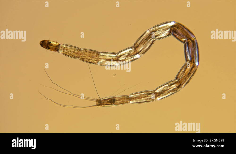 larva biting midges of under a microscope Stock Video Footage - Alamy
