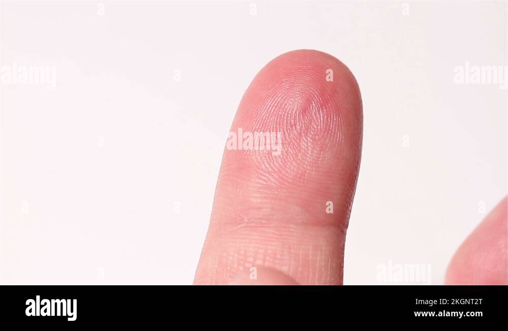 Blood finger test Stock Videos & Footage - HD and 4K Video Clips - Alamy