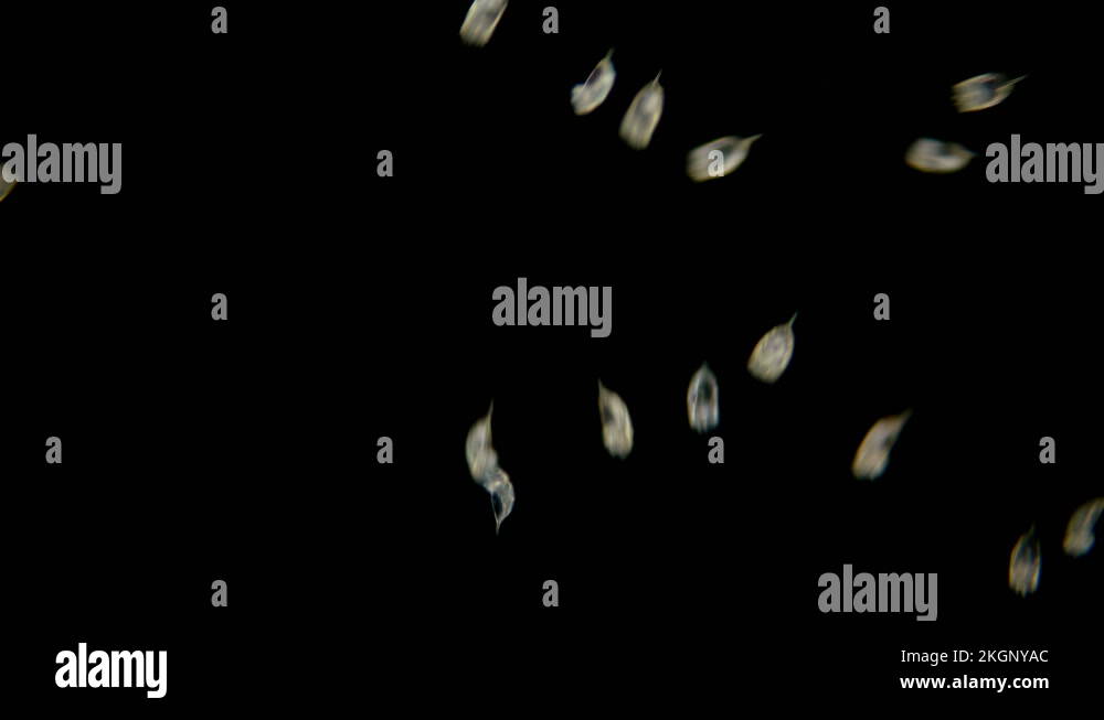 Rotifera Keratella Cochlearis under the microscope Stock Video Footage ...