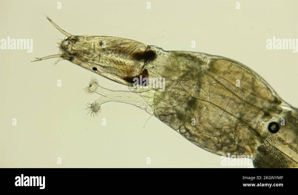 insect larva Chironomidae under the microscope Stock Video Footage - Alamy