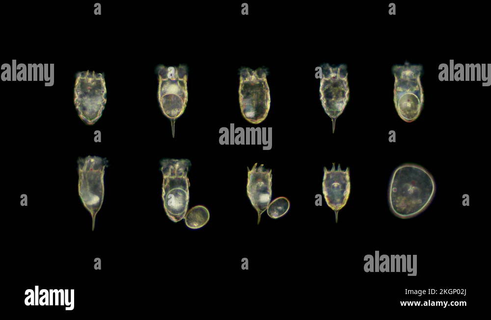 Rotifera Keratella Cochlearis under the microscope Stock Video Footage ...