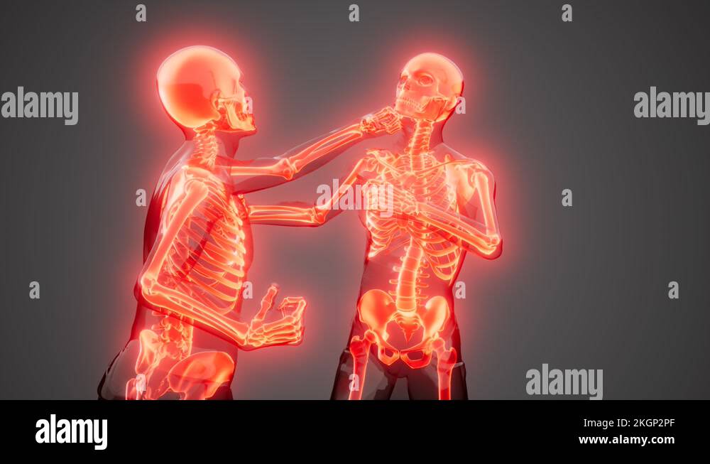 fighting men with visible bones Stock Video Footage - Alamy