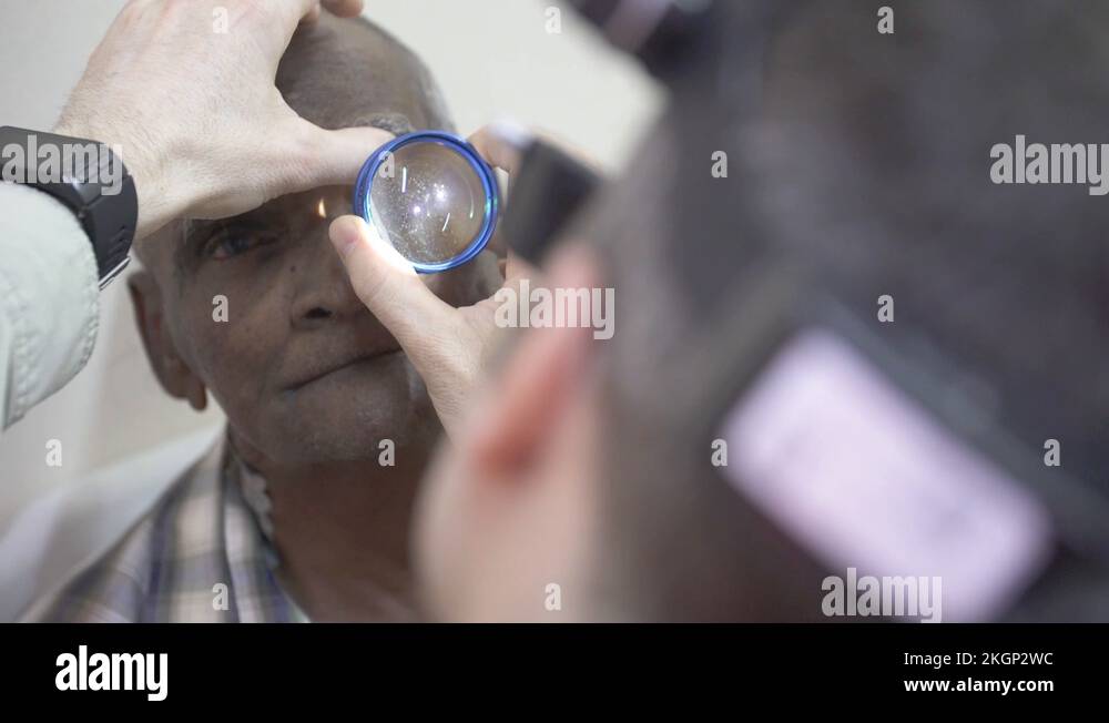 Cataracts in the eyes Stock Videos & Footage - HD and 4K Video Clips ...