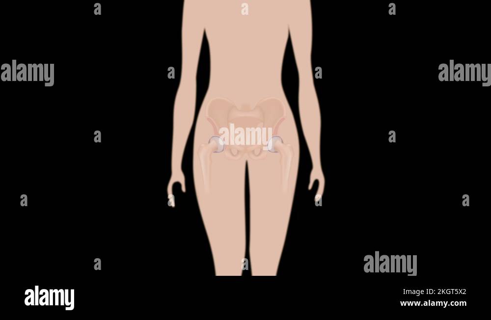 Hip Joint Anatomy Stock Videos And Footage Hd And 4k Video Clips Alamy
