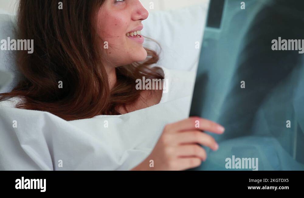 Happy patient looking ray scan Stock Videos & Footage - HD and 4K Video ...