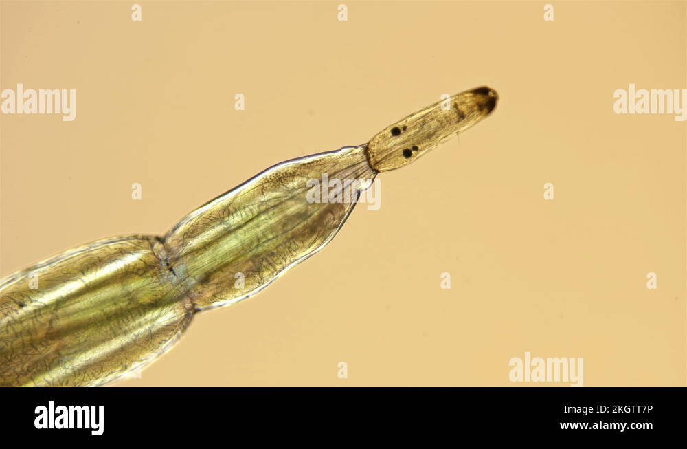 insect larva Chironomidae under the microscope Stock Video Footage - Alamy