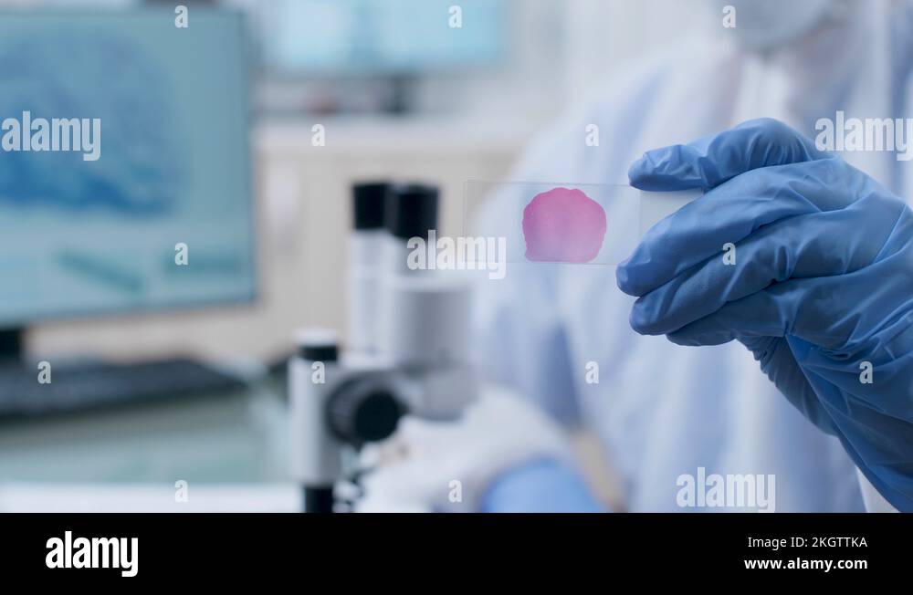 Microscope sample Stock Videos & Footage - HD and 4K Video Clips - Alamy