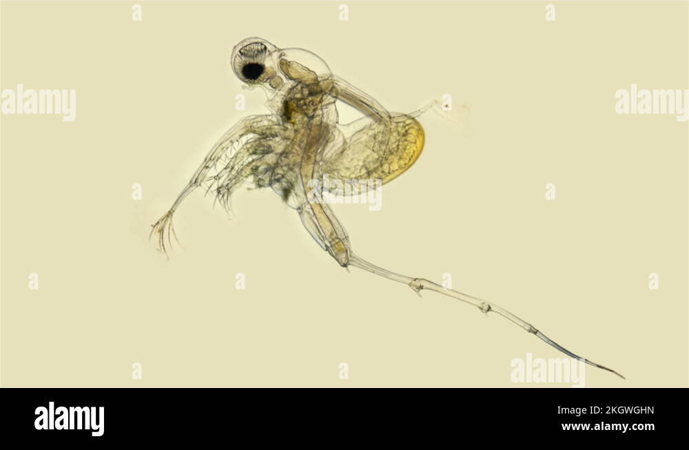 zooplankton under a microscope, prickly water flea Stock Video Footage ...