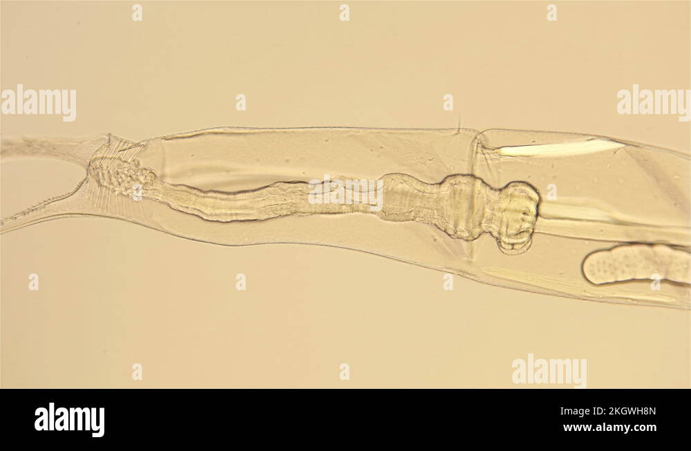 zooplankton under a microscope, the work of the internal organs Stock ...