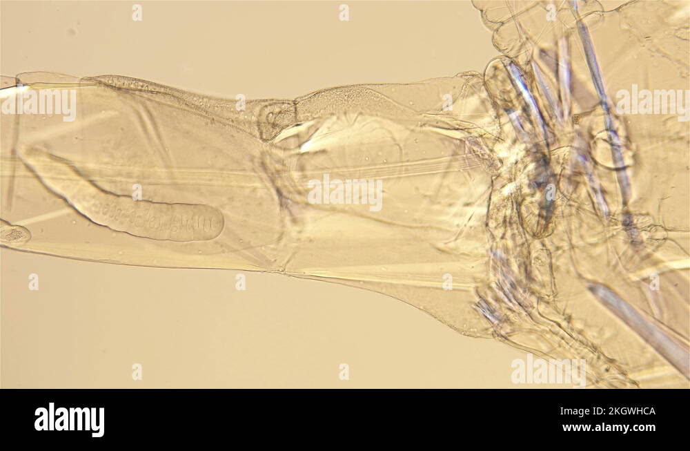 zooplankton under a microscope, the work of the internal organs Stock ...