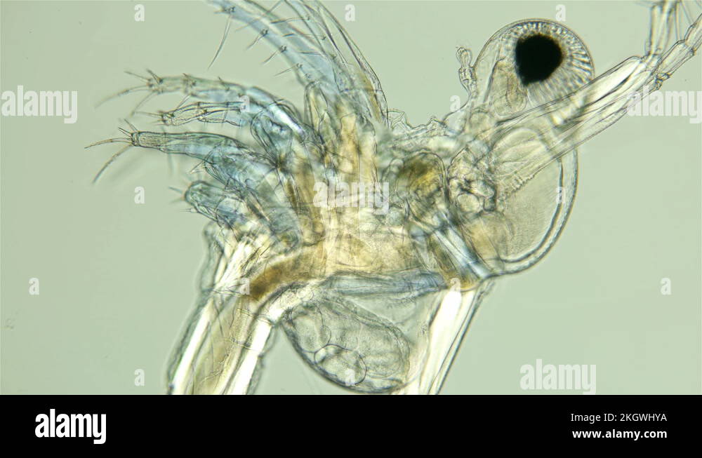 zooplankton under a microscope, prickly water flea Stock Video Footage ...