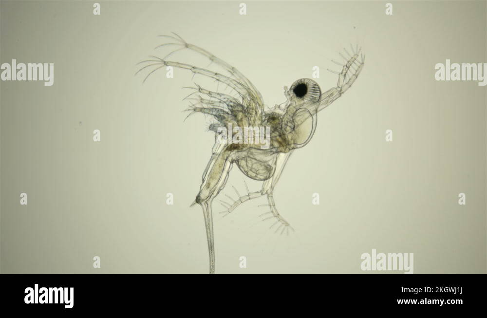 zooplankton under a microscope, prickly water flea Stock Video Footage ...