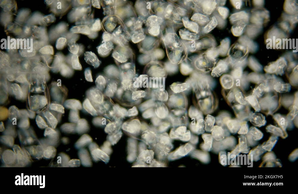 The colony of plankton rotifers Rotifera under a microscope Stock Video ...