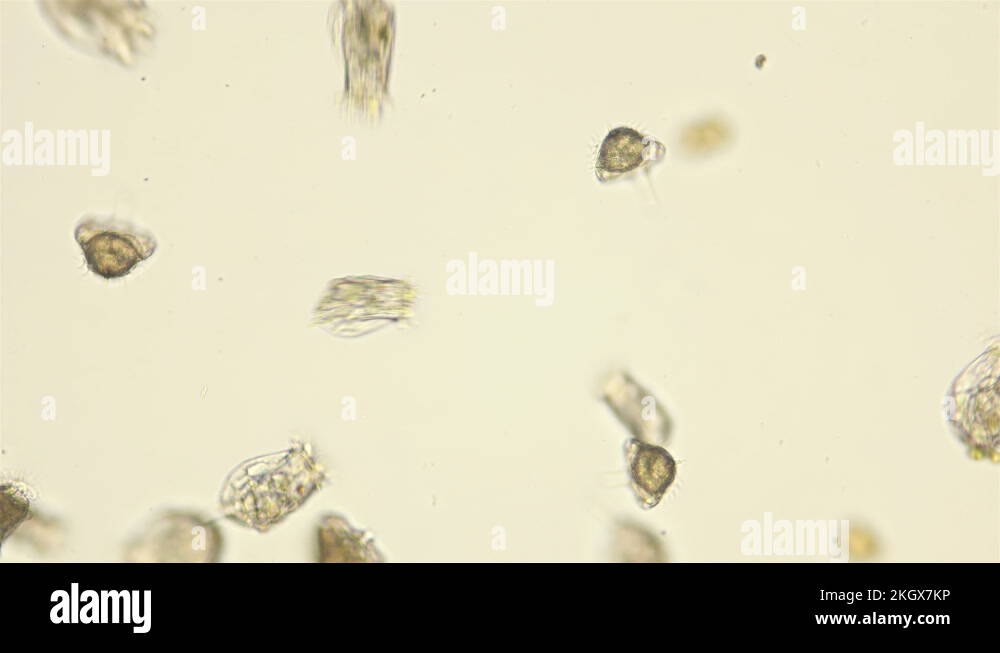 The colony of plankton rotifers Rotifera under a microscope Stock Video ...