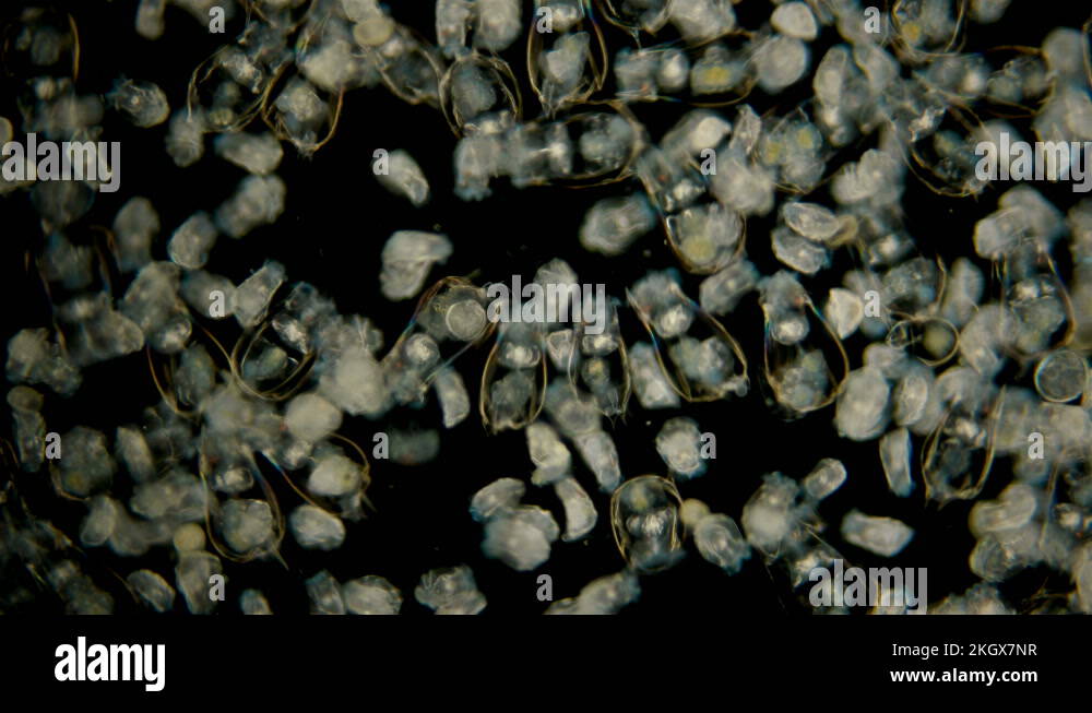 The colony of plankton rotifers Rotifera under a microscope Stock Video ...