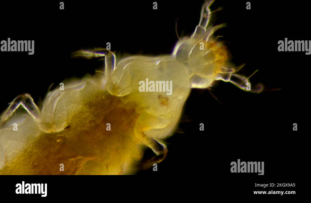 insect larva Worm-shaped, under a microscope Stock Video Footage - Alamy