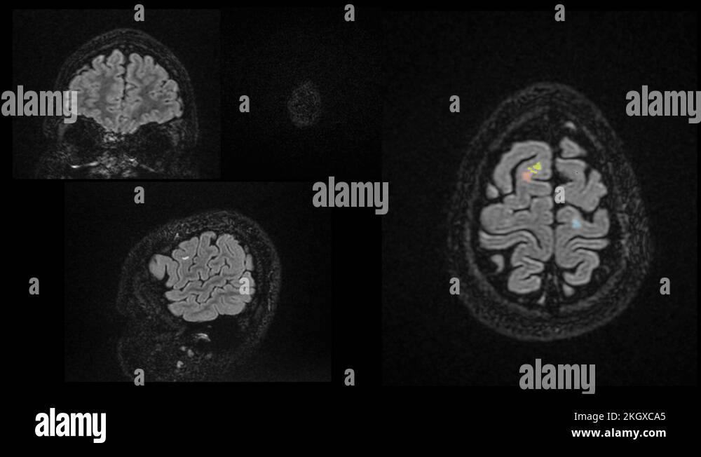 Ms anatomy Stock Videos & Footage - HD and 4K Video Clips - Alamy
