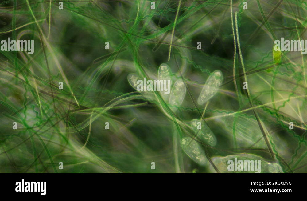 algae under the microscope, the movement of a large number of algae in ...
