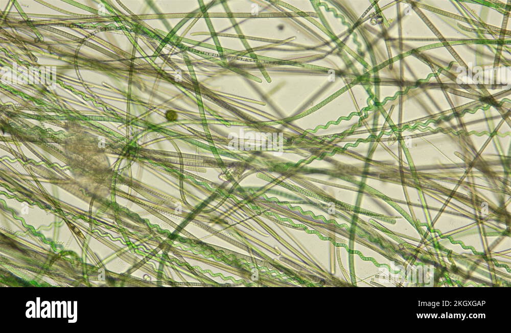 Phytoplankton biodiversity microscope Stock Videos & Footage - HD and ...