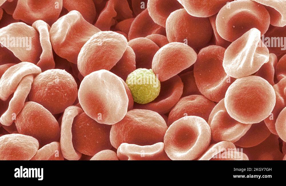 Blood cells and platelets micrograph Stock Videos & Footage - HD and 4K ...