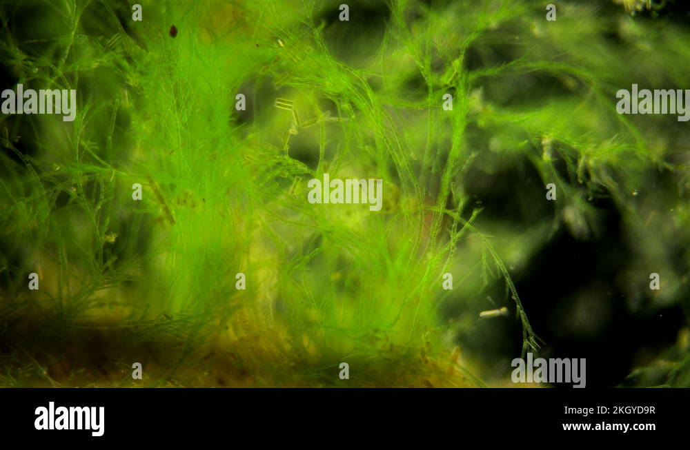 insect larva Chironomidae under the microscope Stock Video Footage - Alamy