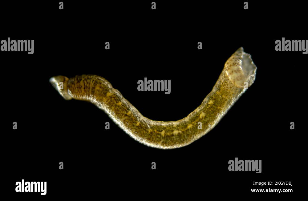 Fish parasite microscope Stock Videos & Footage - HD and 4K Video Clips ...