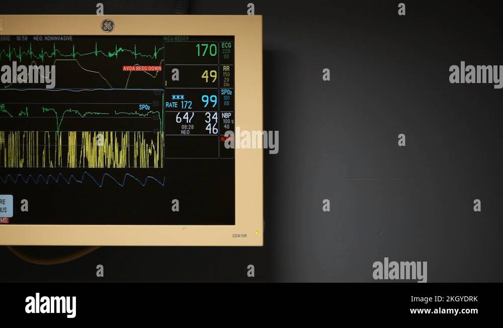 Vitalsigns Stock Videos & Footage - HD and 4K Video Clips - Alamy